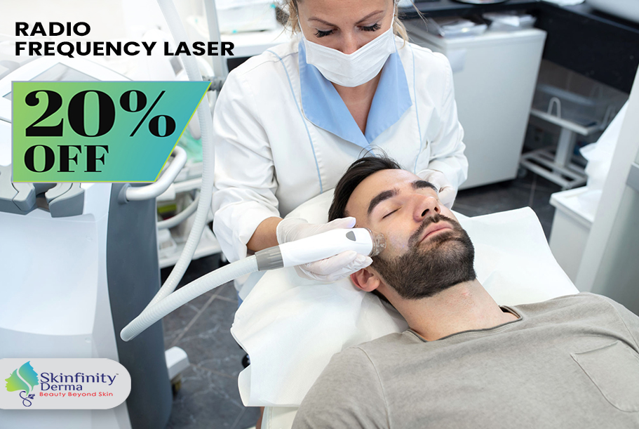 Radio Frequency (RF) Laser Treatment in Noida | Skinfinity Derma