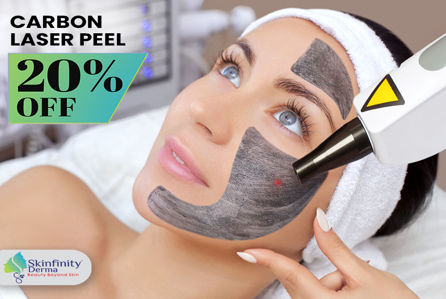 Hollywood Peel - Carbon Laser Peel Cost in Noida | Skinfinity Derma